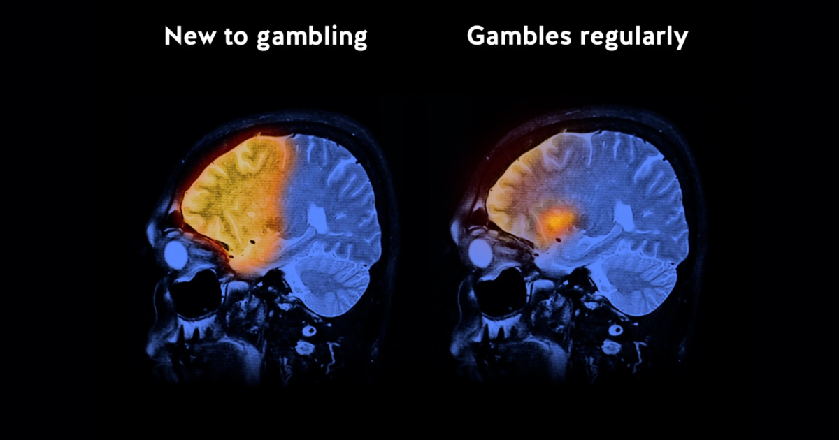 The Science of Addiction & Gambling| Gambler's Help